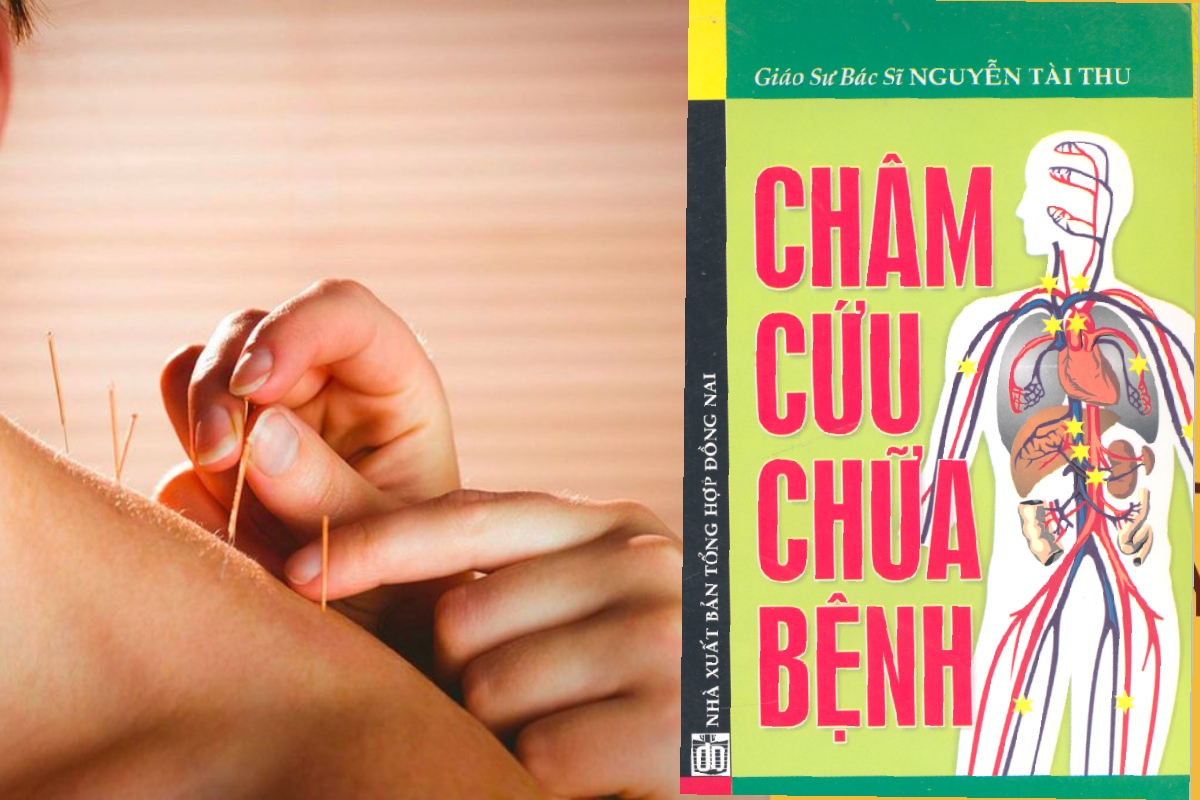 [TẢI PDF MIỄN PHÍ] Châm Cứu Chữa Bệnh - MyHanoi